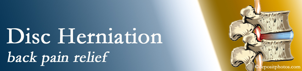 Vancouver Disc Herniation Relief | Vancouver Disc Centers