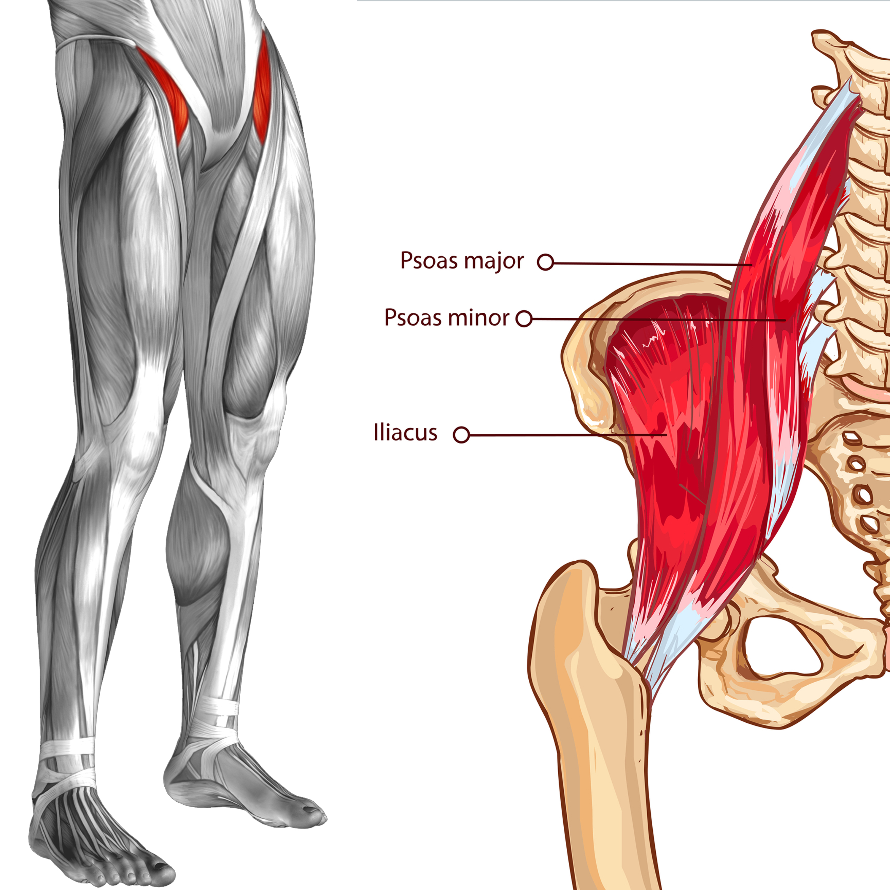 Iliopsoas Muscle and Back Pain Link and Exercise | Vancouver Disc Centers